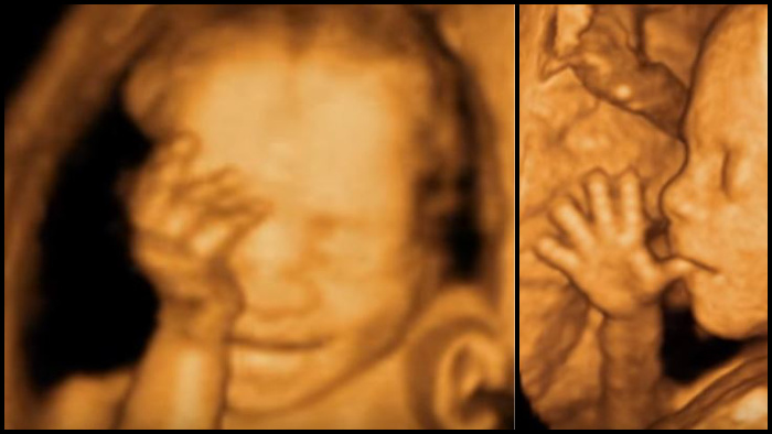 4D Ultrasound Shows Baby Waving At Camera! - Faithreel.com